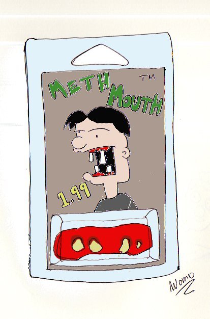 Meth Mouth